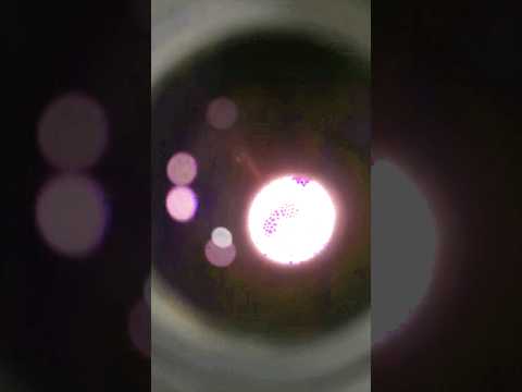 Candida albicans under the microscope #laboratory #medtechstudent #mls #cls #candidiasis #candida