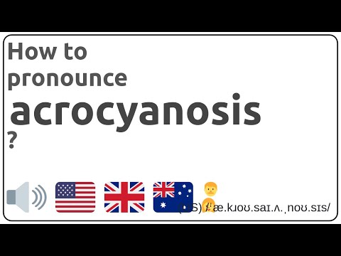 How to pronounce acrocyanosis in english?