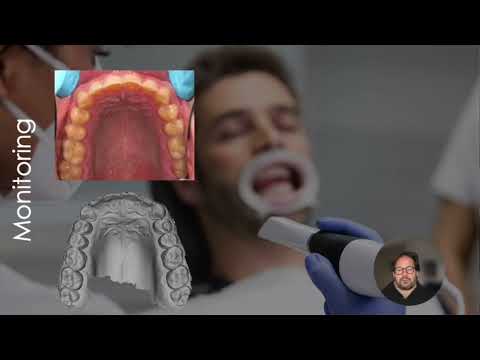 ConsEuro Speakers: Prof. Bas Loomans "Tooth wear management".