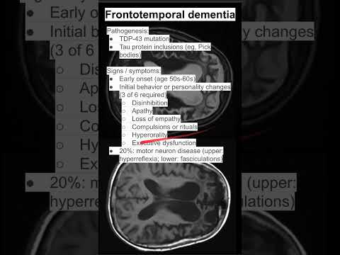 Frontotemporal dementia