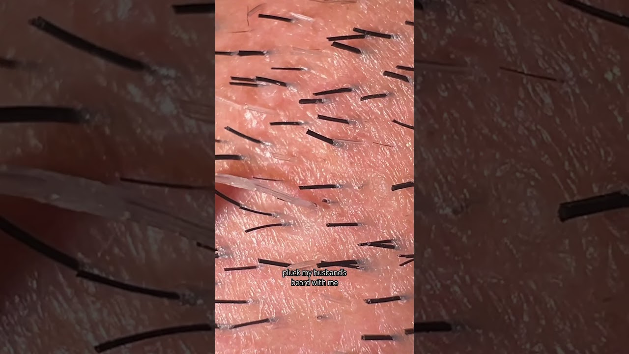 pluck my husband’s beard hair with me 🤭 #asmr #tweezer #pluckingasmr #satisfying #beard #extraction