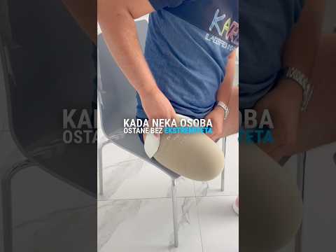 KADA NEKA OSOBA OSTANE BEZ EKSTREMITETA #proteze  (proteza za nogu)