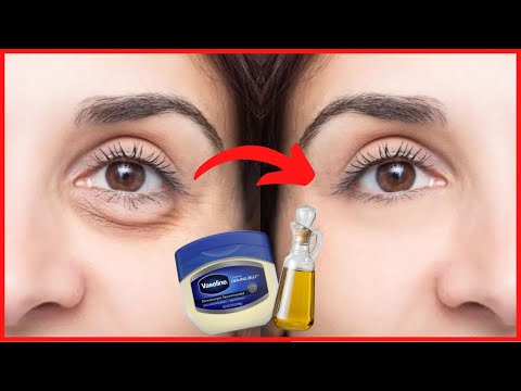 In just 3 days 🌹 Remove Under Eye Bags, Dark Circle, Wrinkles, and Puffy Eyes COMPLETELY!!!