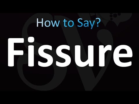 How to Pronounce Fissure (correctly!)