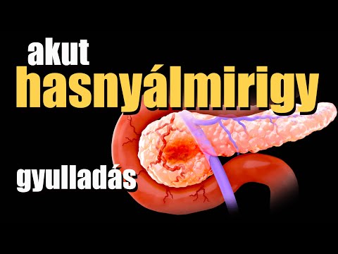 Fő oka: zsíros étel | 5-ből 1 életveszélyes | Tünetek, megelőzés |