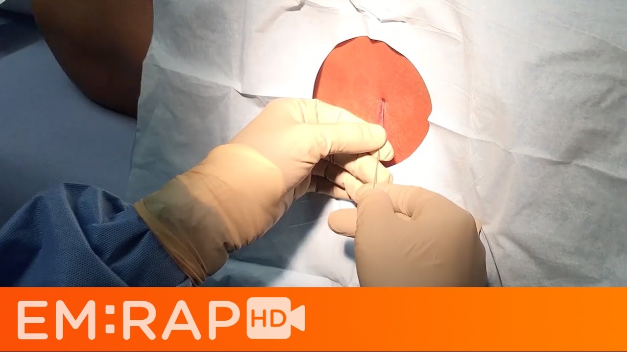 Lumbar Puncture Tutorial