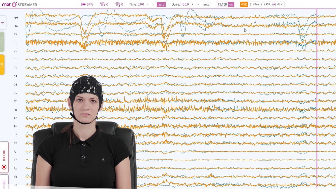 EEG artifacts removal with ASR