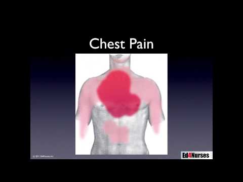 Complications of Delays in STEMI Treatment