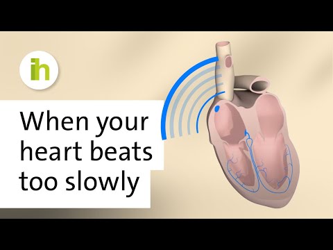 Irregular and slow heartbeat: What is an AV block?