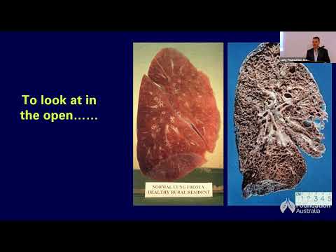 What is PF/ILD: Disease pathways and treatment