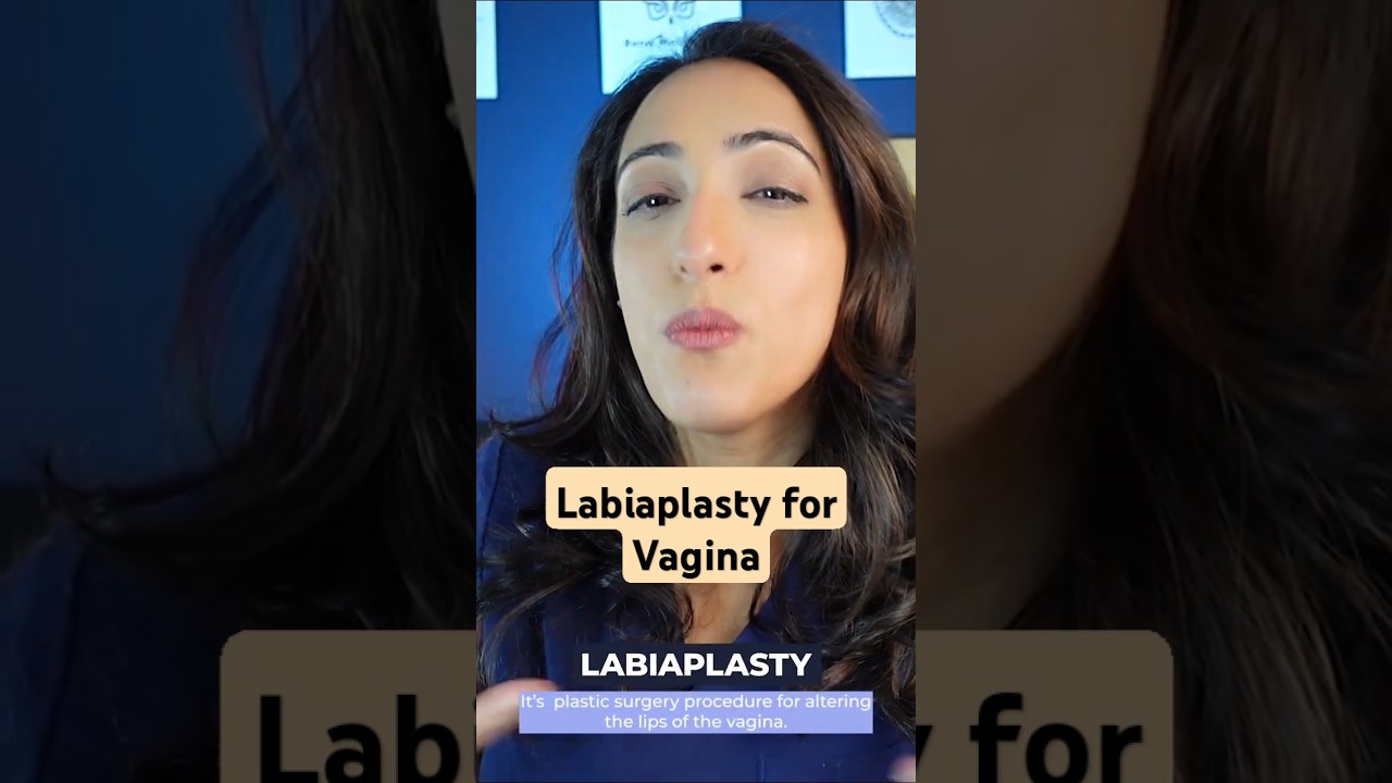 What is labiaplasty?