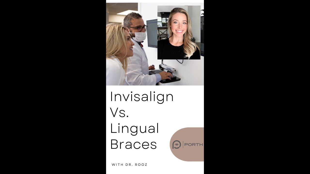Invisalign vs lingual braces which one should I pick?