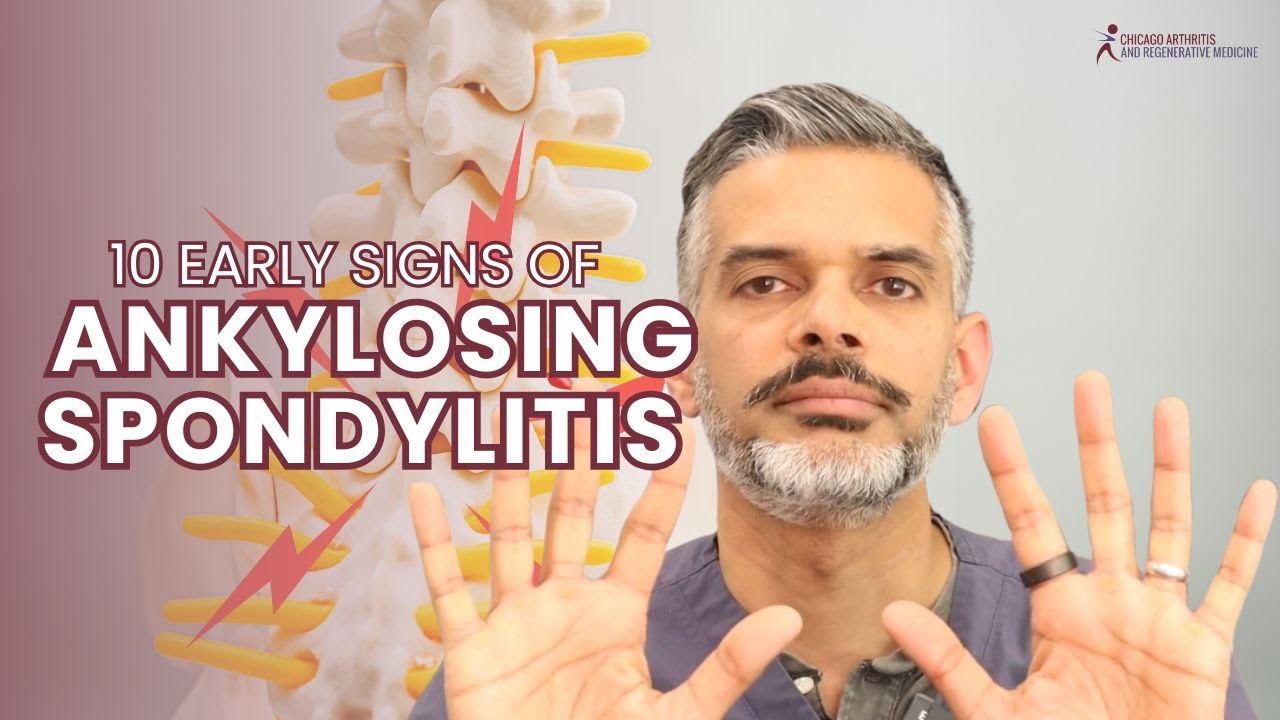10 Early Signs of Ankylosing Spondylitis You Shouldn’t Ignore ...
