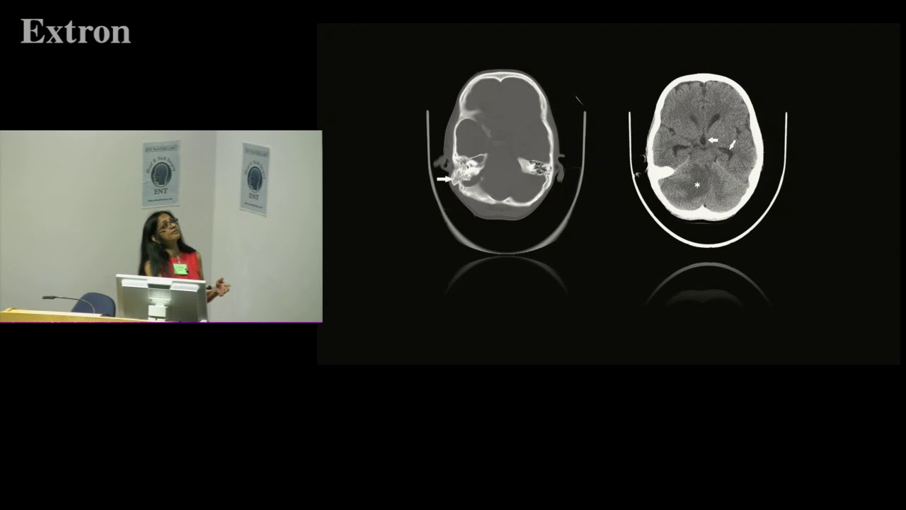 ENT Emergency Radiology