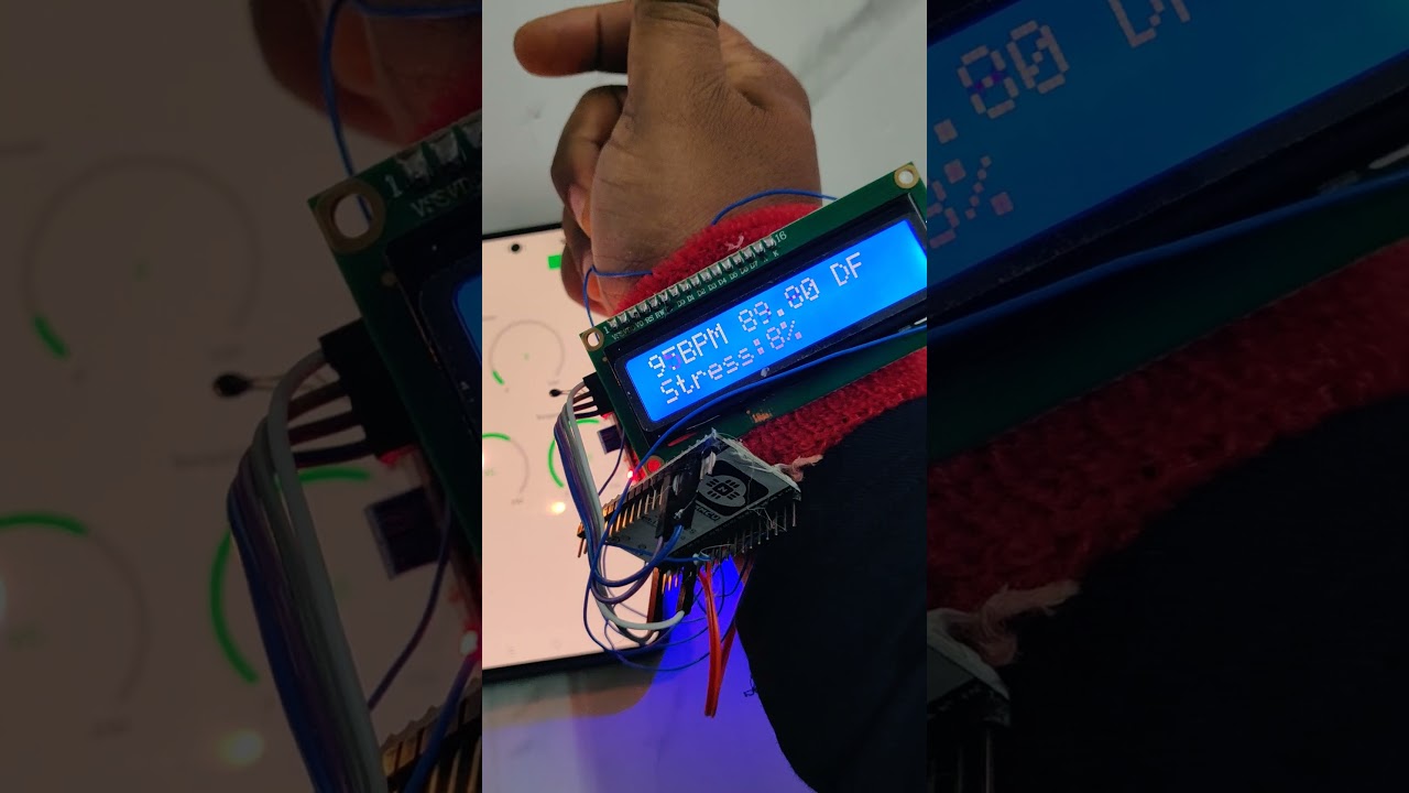 HVS-3318. Stress Analysis and Care Prediction System with Blynk monitoring and Email alerts#esp32
