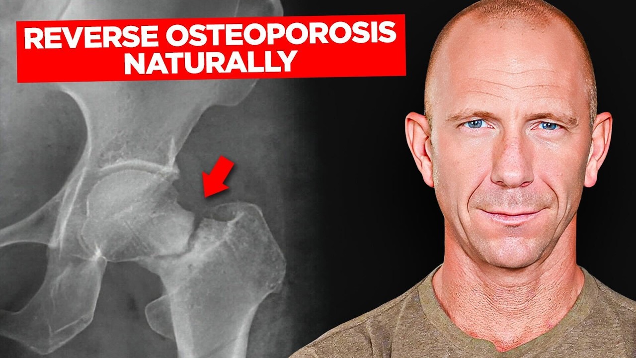 How to Strengthen your Bones and Reverse Osteoporosis Naturally [Patient Case studies]
