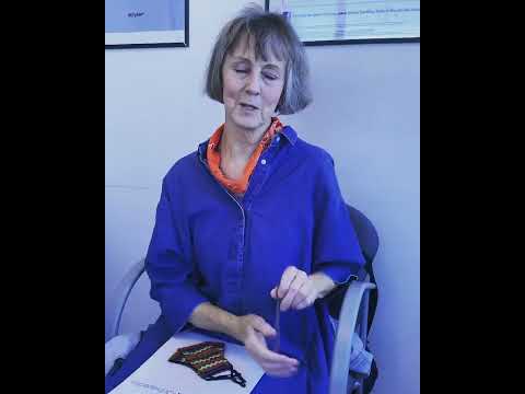 Los Angeles Direct Anterior Hip Replacement Surgery in Los Angeles | Hip Replacement Recovery Time