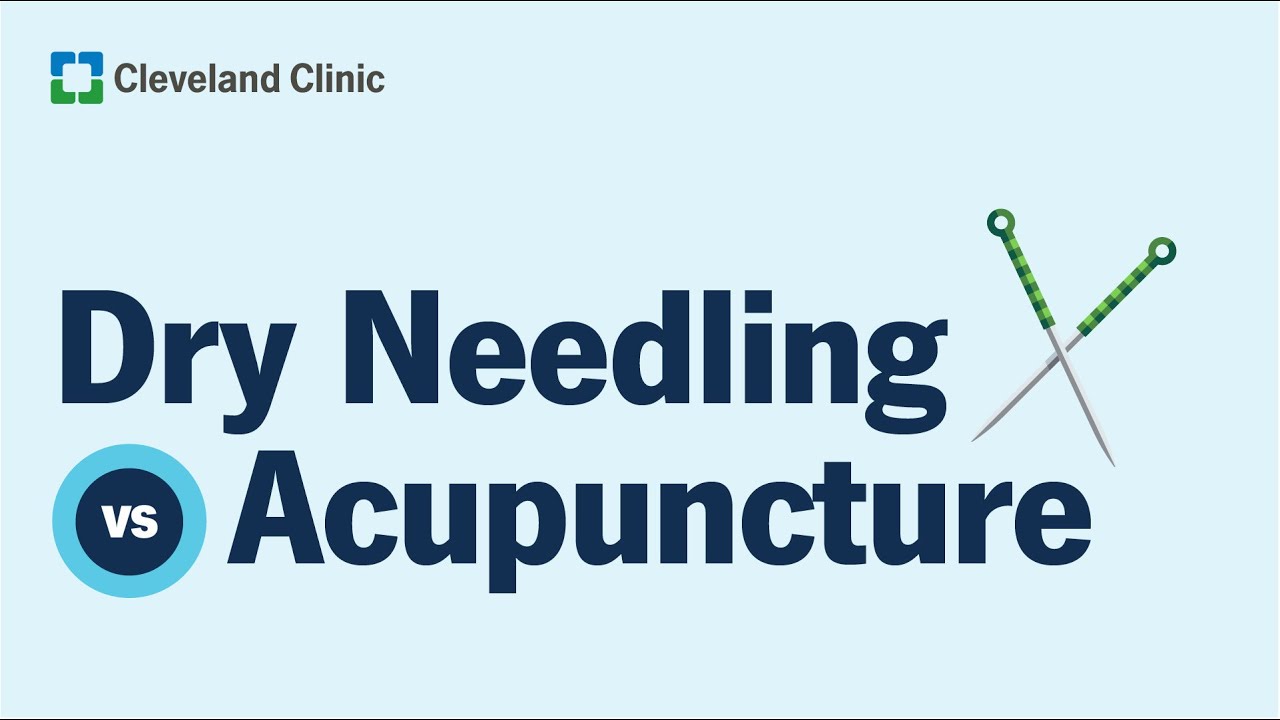 Dry Needling vs. Acupuncture: What’s the Difference?