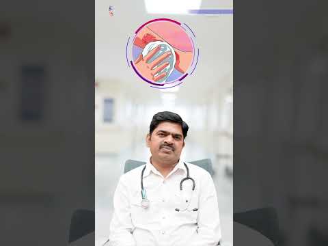 సెల్యూలైటిస్ తగ్గడానికి ఎంత సమయం పడుతుంది | Cellulitis | KBK Hospital
