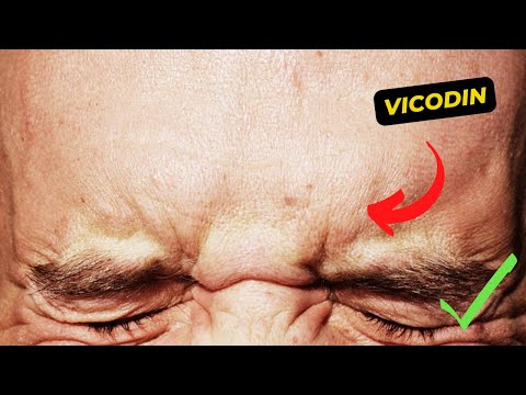 Understanding the Risks and Benefits of Vicodin