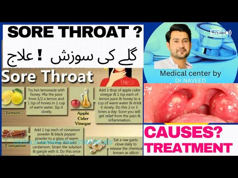 what are the causes of a sore throat ? Home remedies & treatment | medical center by Dr.Naveed