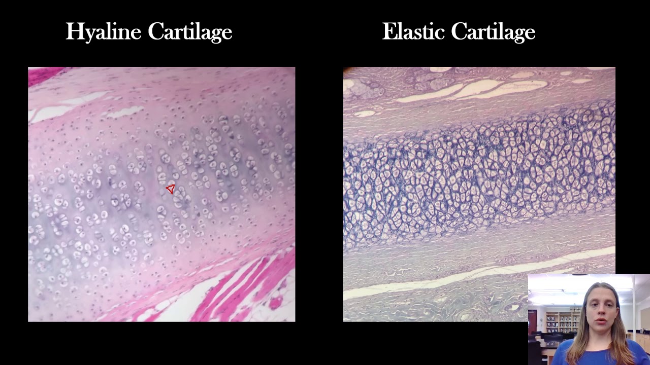 The 4 Most Commonly Confused Tissue Types
