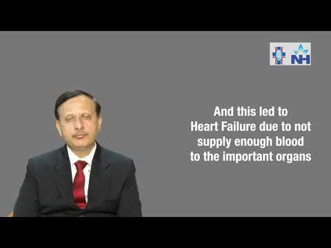 What is Heart Failure? Symptoms & Risks Explained