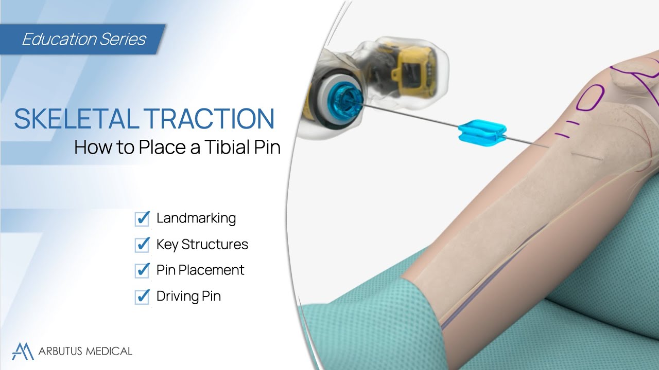 How to Place a Tibial Pin - Skeletal Traction Animation
