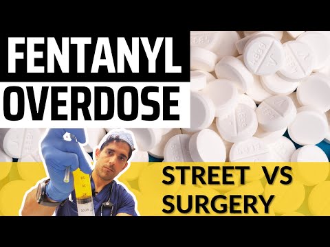 Fentanyl Overdose: Street vs Surgery (and San Francisco Opioid Crisis)