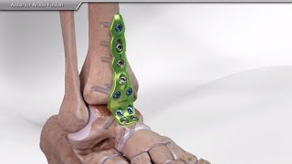 Patient Education in Orthopedic Surgery – OrthoPedia Patient