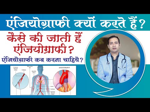 Angiography Explained!