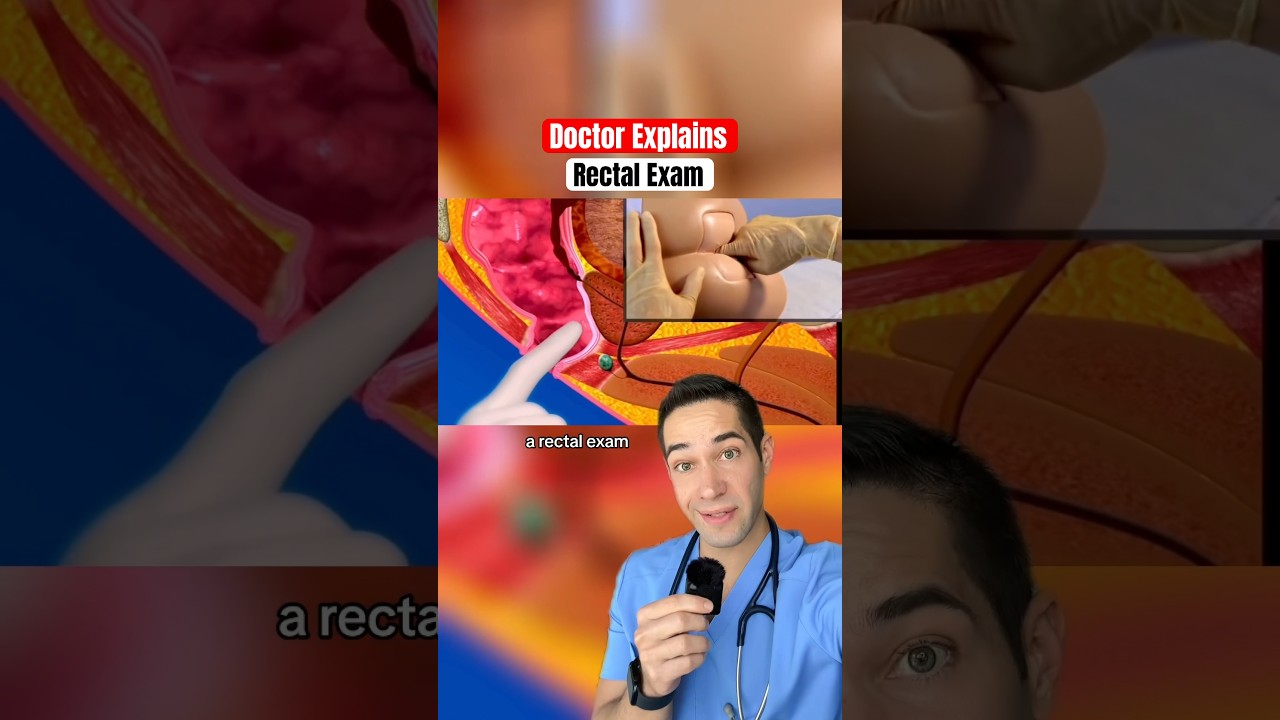 How to give a rectal exam!