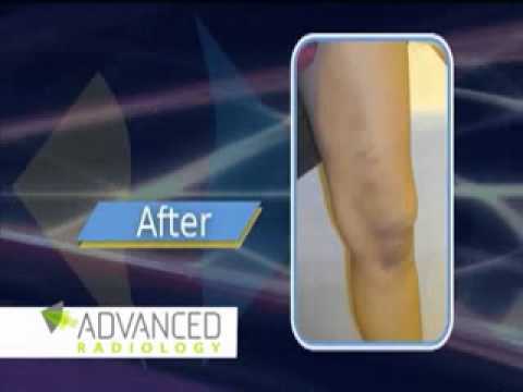 Advanced Radiology Lincoln, NE
