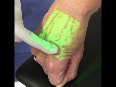 AccuVein AV500 Vein Wipe