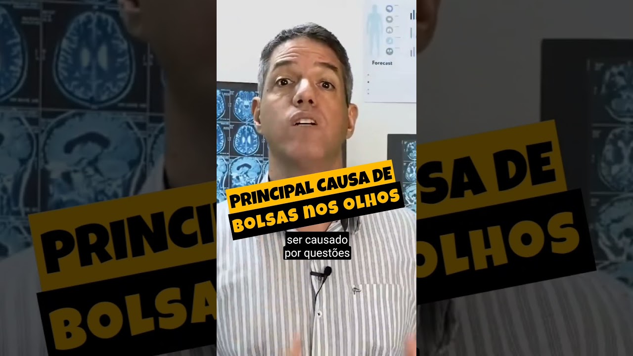 Dark circles BAGS - the main cause of bags under the eyes - Dr Alain Dutra