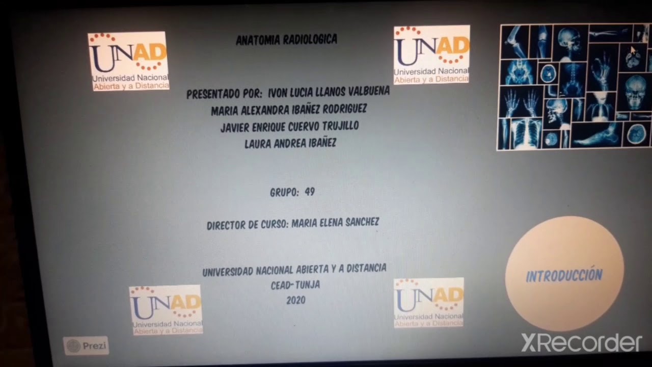 ANATOMÍA RADIOLÓGICA presentación Prezi