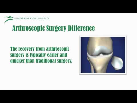 Knee Arthroscopy Explained -- The Less Invasive Knee Surgery