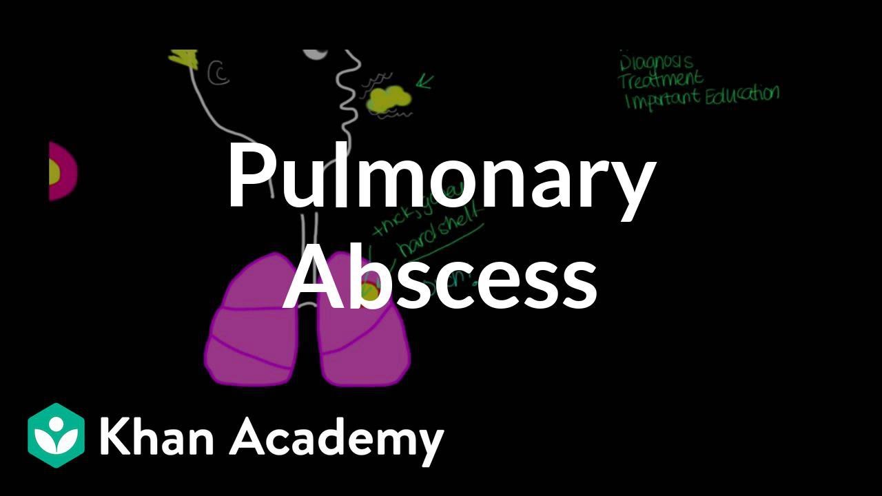 Pulmonary abscess | Respiratory system diseases | NCLEX-RN | Khan Academy
