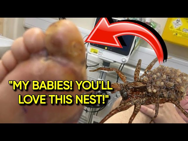 "Thanks for permanent nightmares": Peruvian wolf spider eggs in toe ...