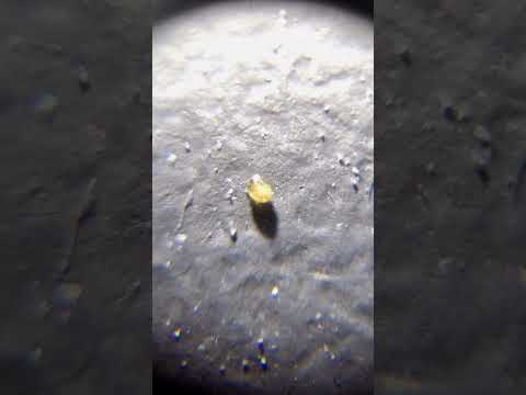 Scabies mite under a 60x Microscope.