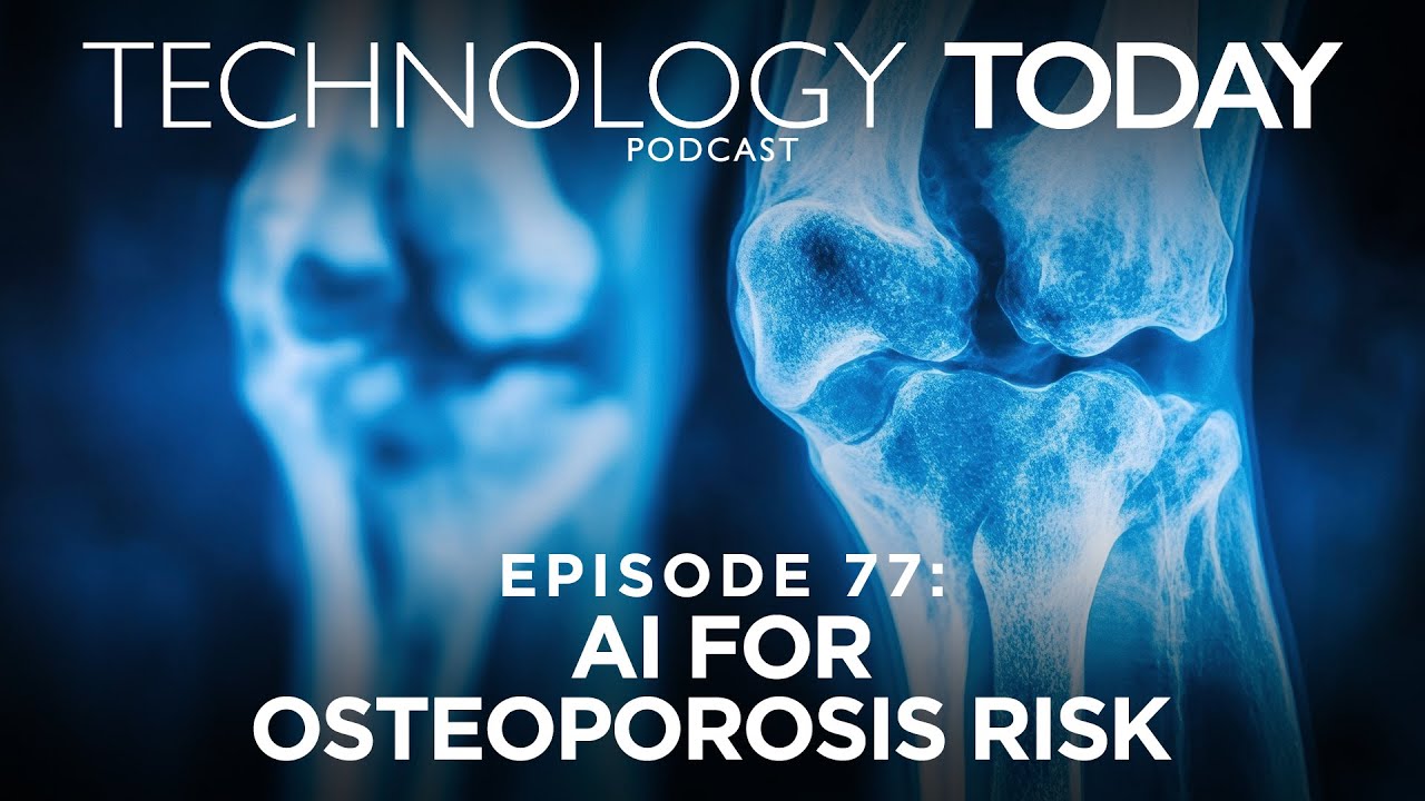Podcast episode 77: AI for Osteoporosis Risk