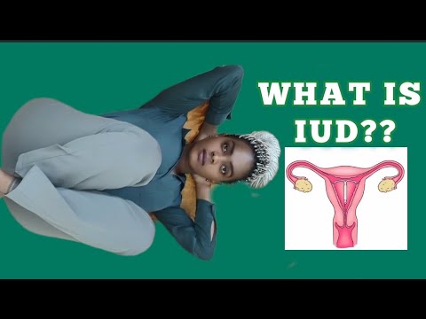 DISCOVER IUD (CONTRACEPTIVES PART 1)