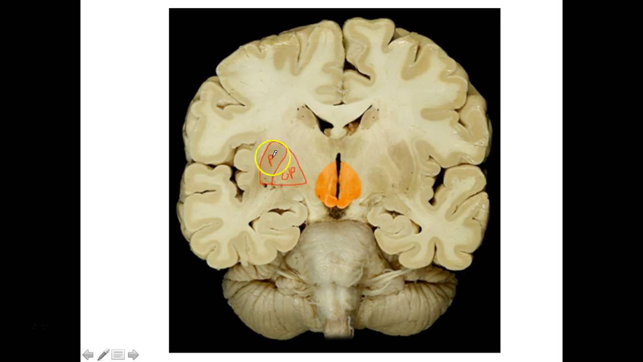 CNS Lab Walk Through