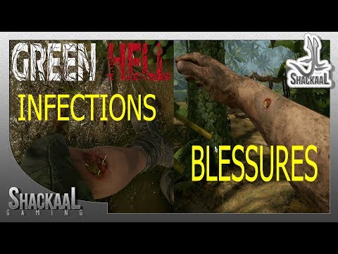 Steam Community :: Video :: GREEN HELL - BLESSURES , INFECTIONS ET ...