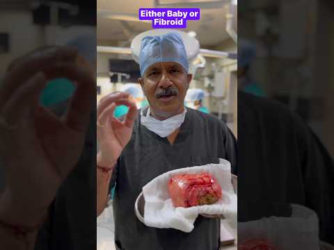 Either Baby or Fibroid . #pregnant #baby #fibroidremoval #babybirth #uterus #8yearwait