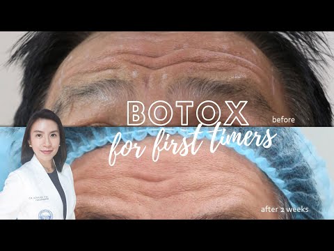 Botox Tips for First Timers! – Dermalogique