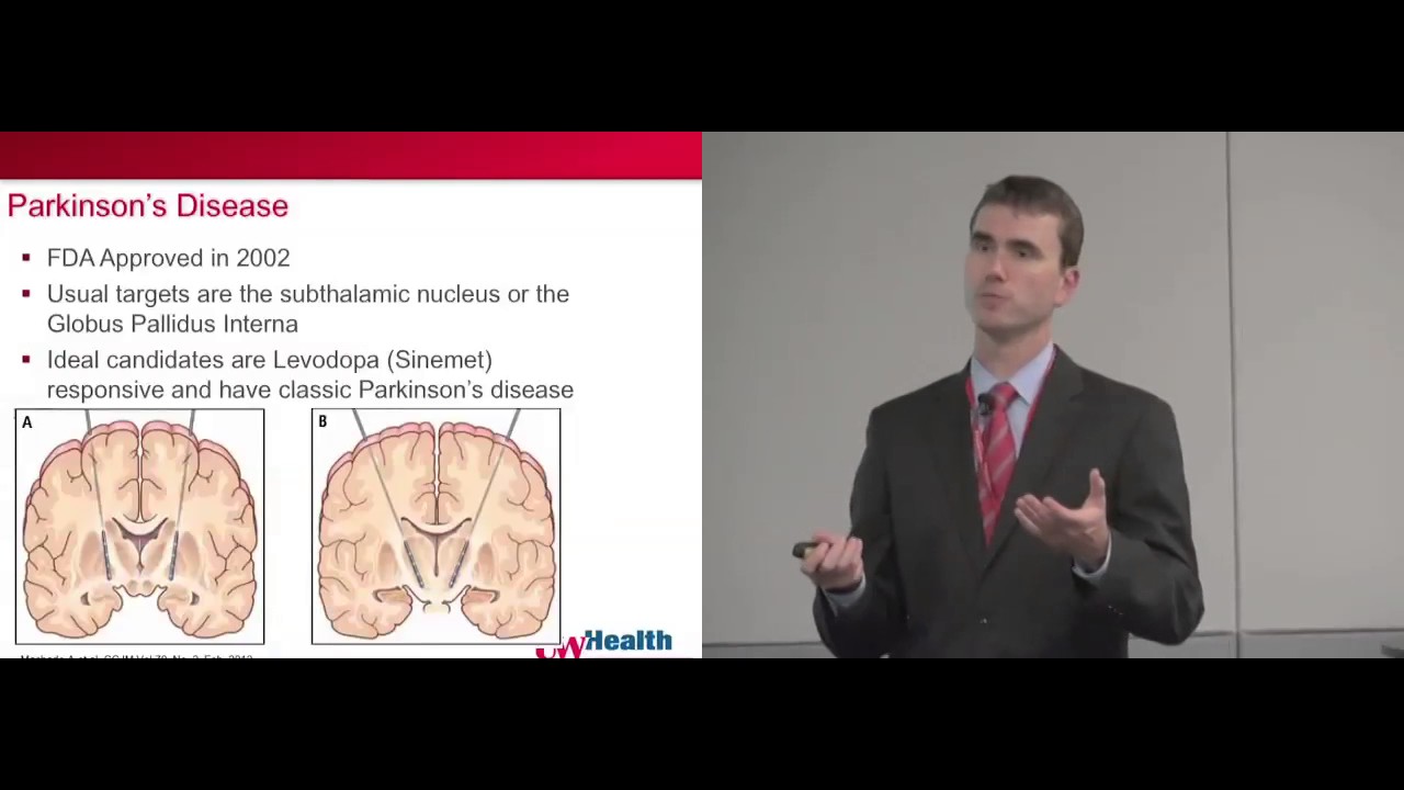 Moving Forward: Deep Brain Stimulation for Movement Disorders