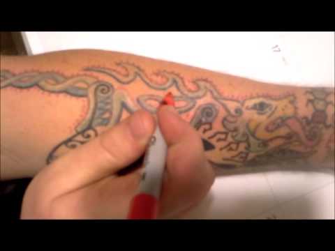 Allergic Reactions Tattoo University