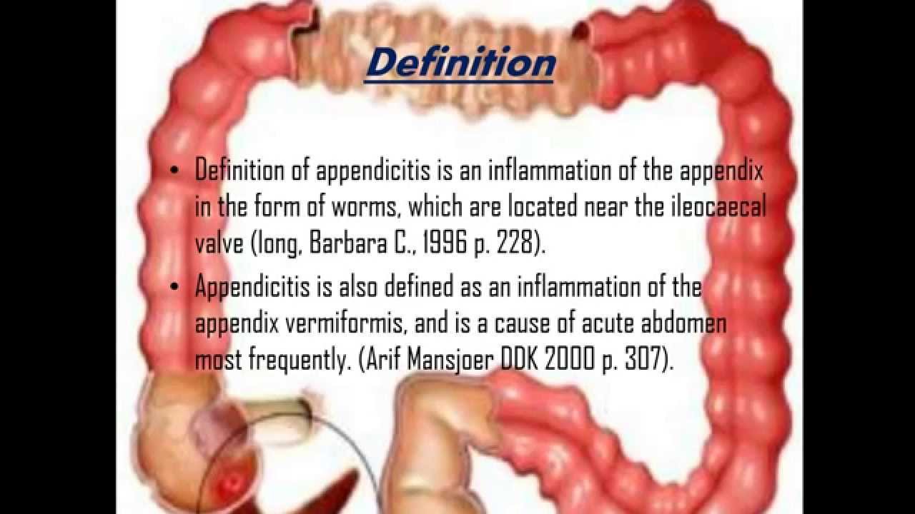 PPT English Appendicitis