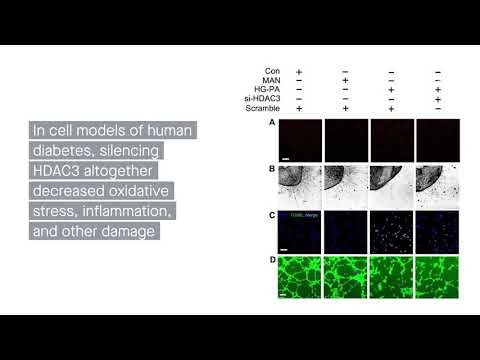 HDAC3: A new target in treating diabetic vasculopathy